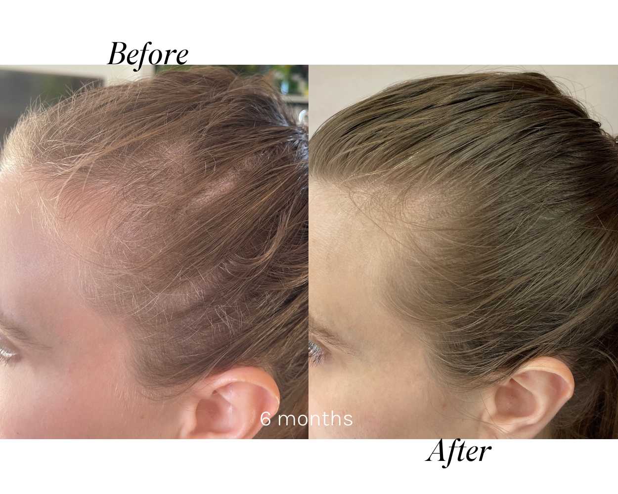 Hair Growth Heroes | The Inside Out Method – CENTRED.®