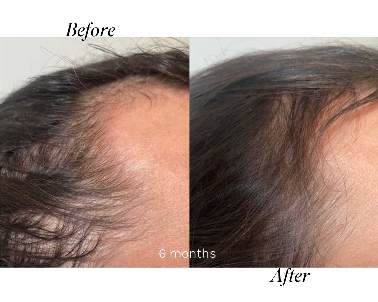 Tender Love and Hair Supplement | Hair Growth Vitamins with Bamboo ...